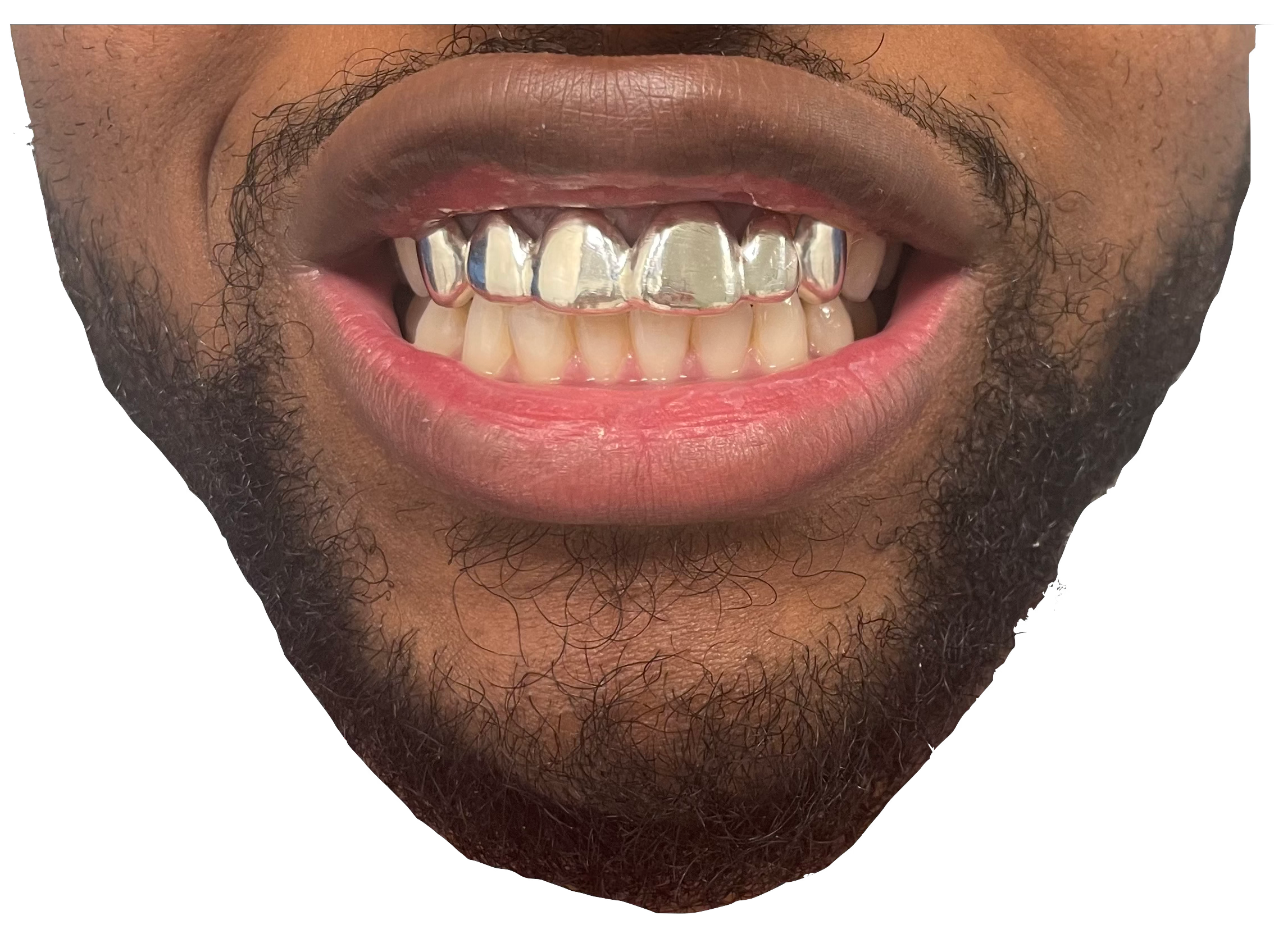 A TRUE CLASSIC – The Grillz Doctor